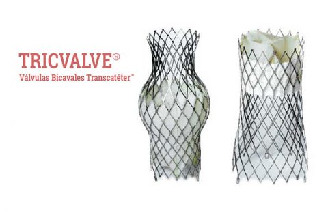 Válvulas transcatéter TricValve - Siprotec