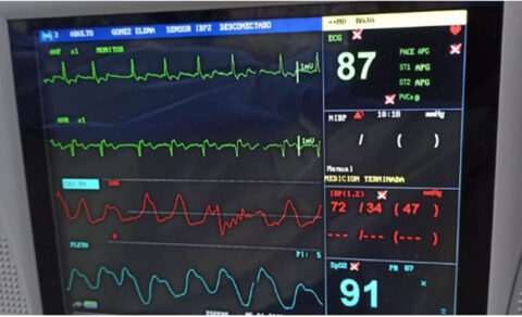 Caso Clínico Tricvalve - Siprotec